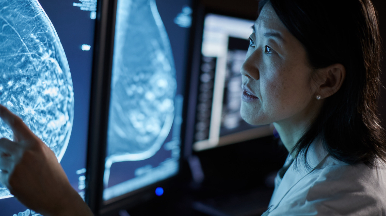 AI Innovations in Cancer Screening | Insights | Hologic® UK